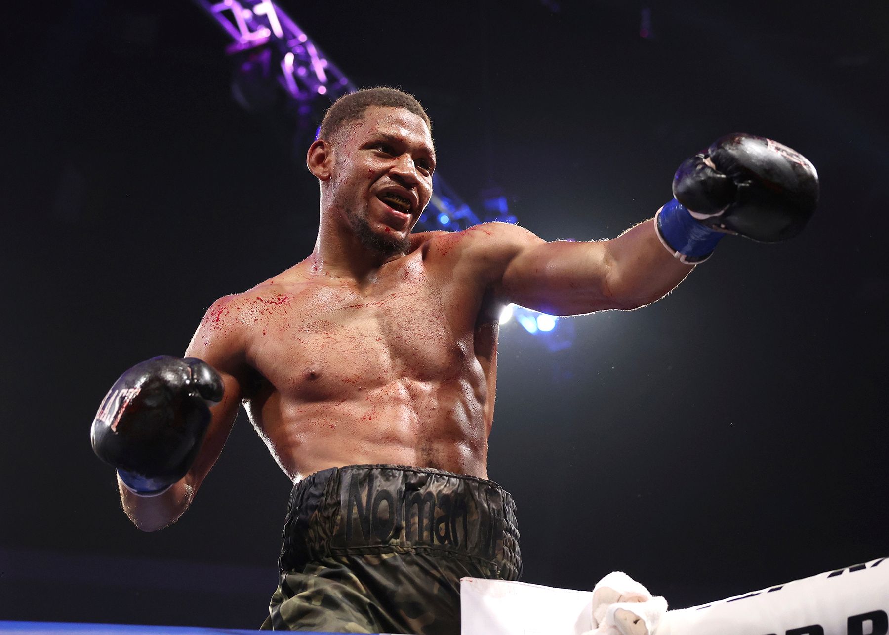 Brian Norman 'Can Go Full Blast' Against Derrieck Cuevas After Second Surgery On Left Hand